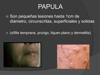 Sintomas de piel y mucosas | PPTX