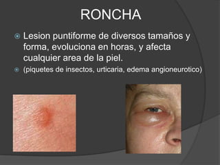 Sintomas de piel y mucosas | PPTX