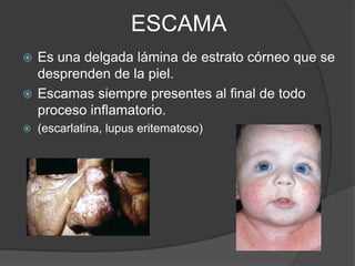 Sintomas de piel y mucosas | PPT