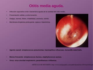 Otitis media bacteriana, AGUDA Y CRÓNICA.