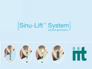 Sinus lift | PPT