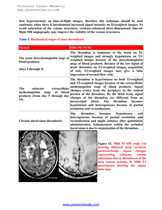 Radiological pathology of cerebral venous & dural sinus thrombosis | PDF