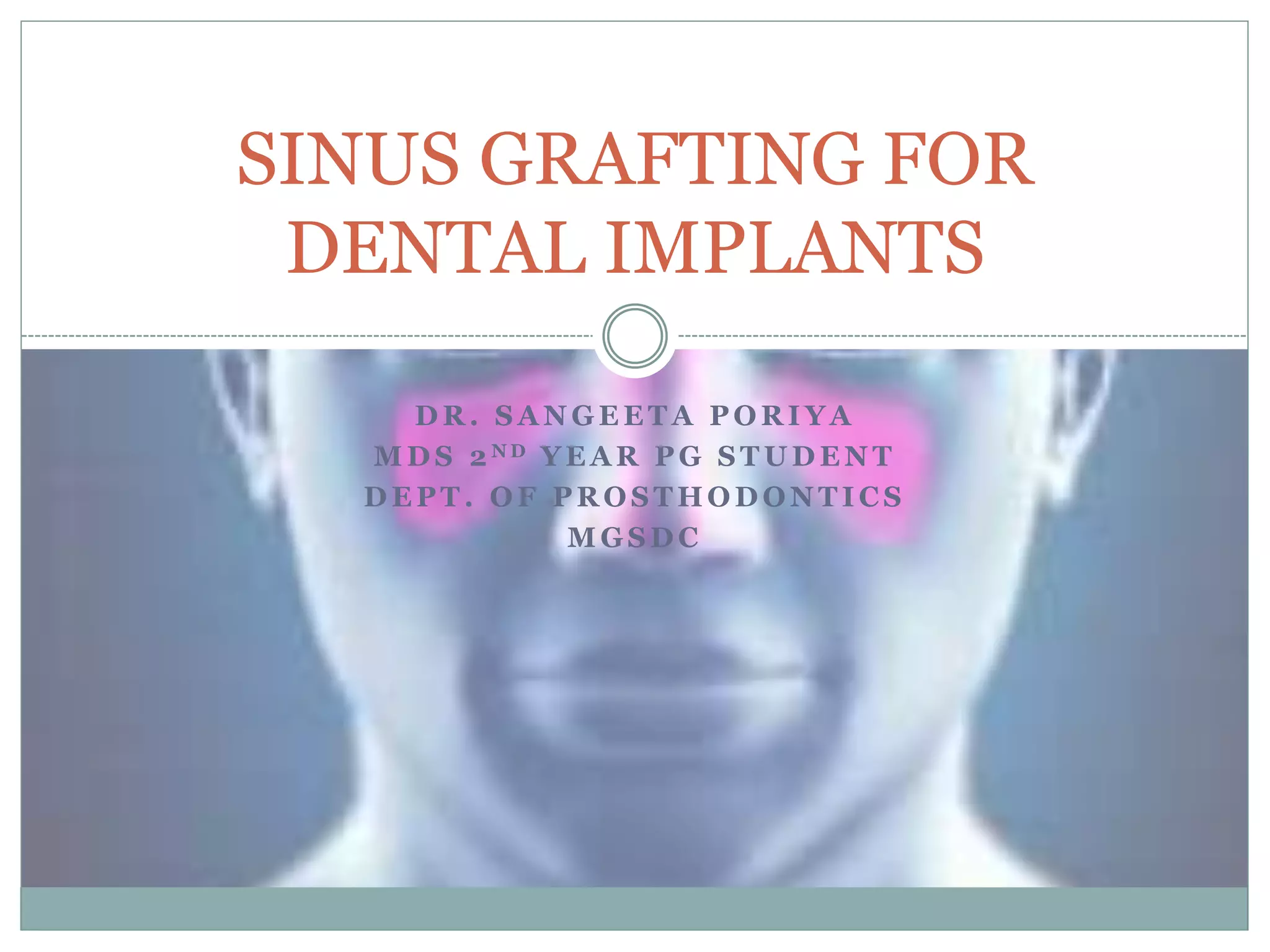 Sinus Lift with implant placement-surgical approach | PPTX