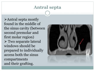 Sinus Lift with implant placement-surgical approach | PPTX