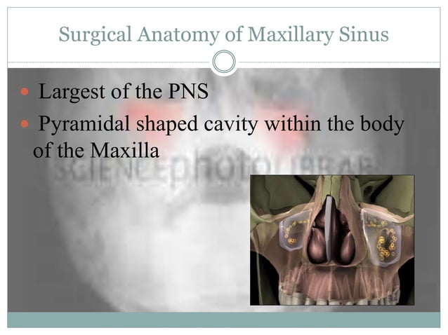 Sinus Lift with implant placement-surgical approach | PPTX