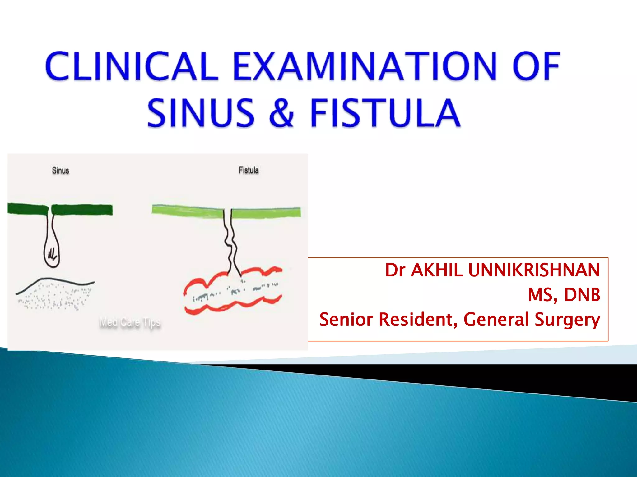SINUS.pptx
