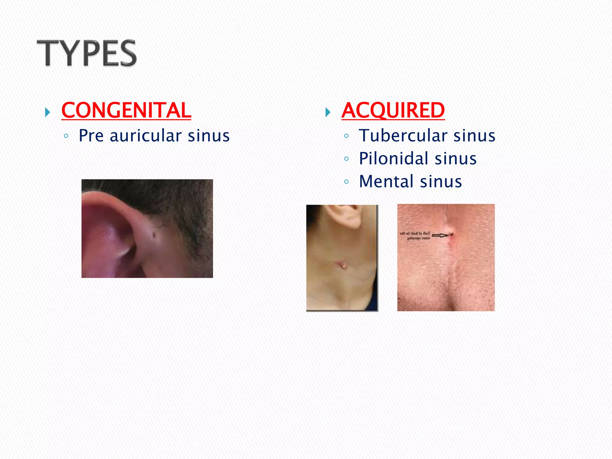 SINUS.pptx