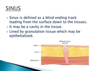 SINUS.pptx