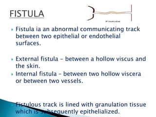 SINUS.pptx