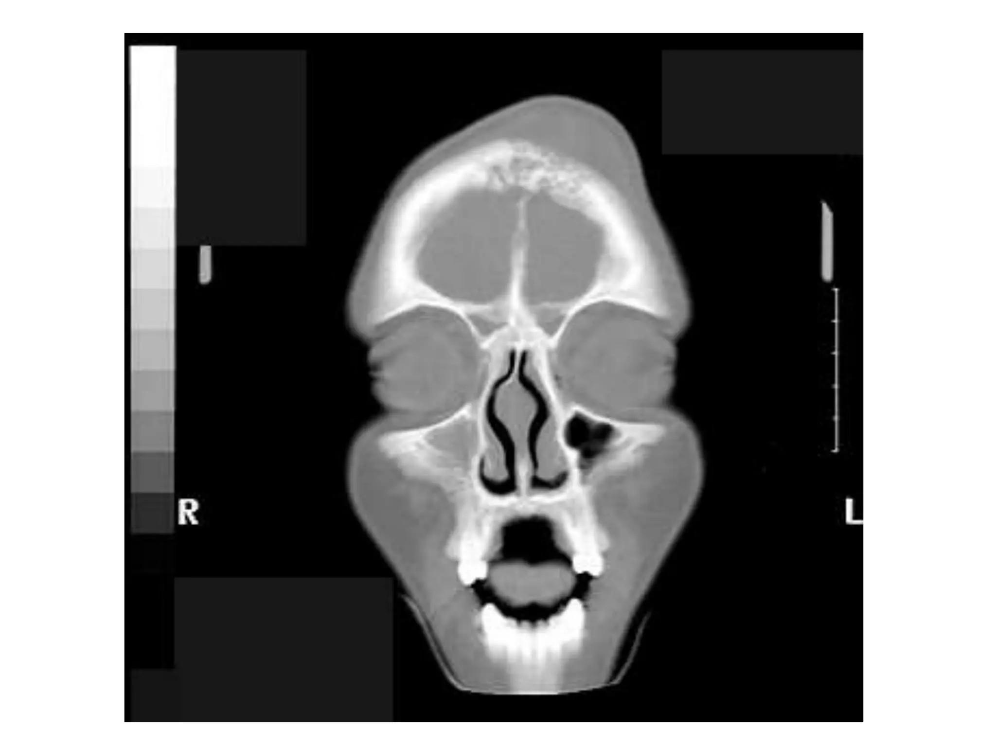 Sinus-Imaging.ppt