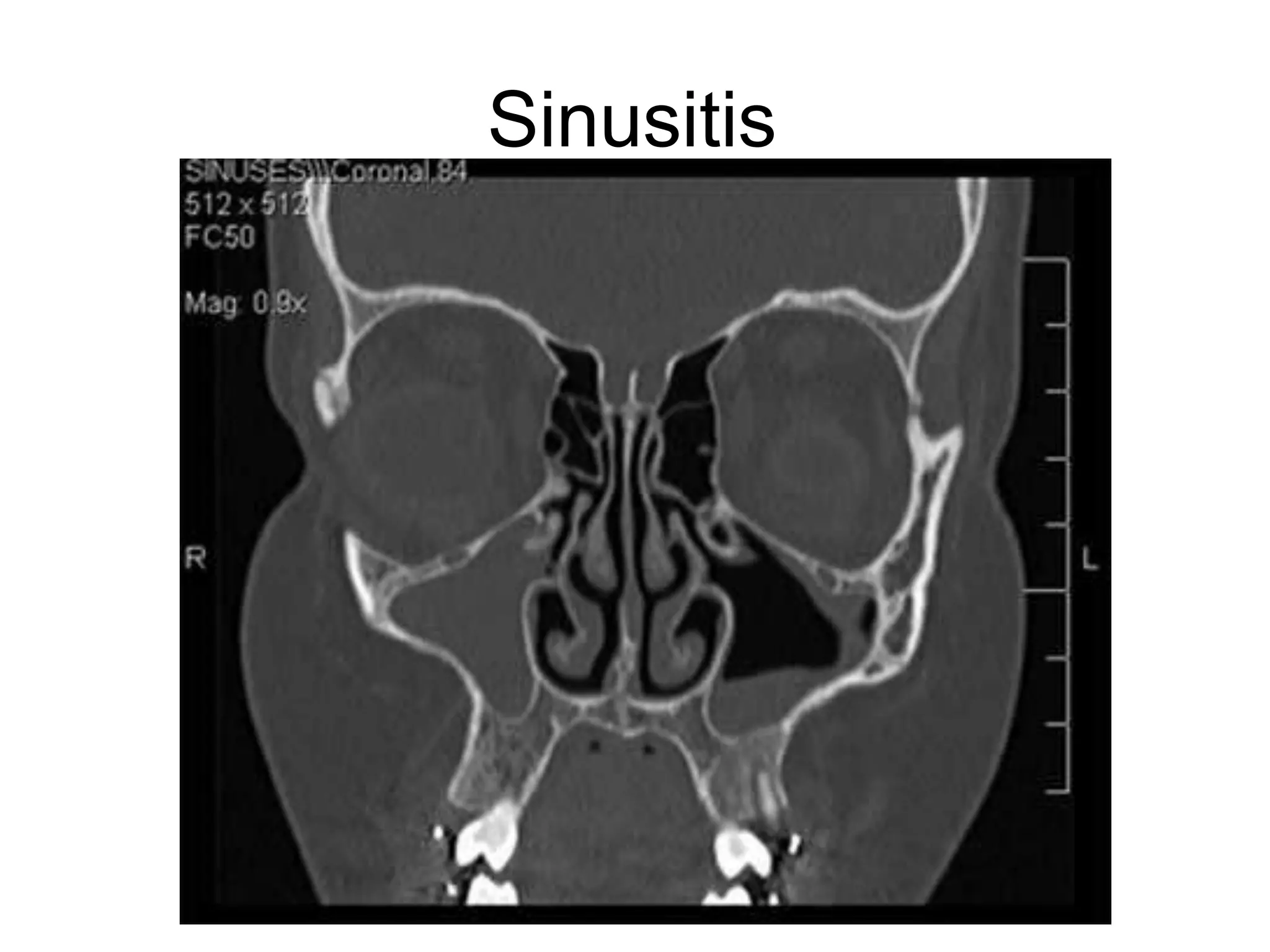 Sinus-Imaging.ppt