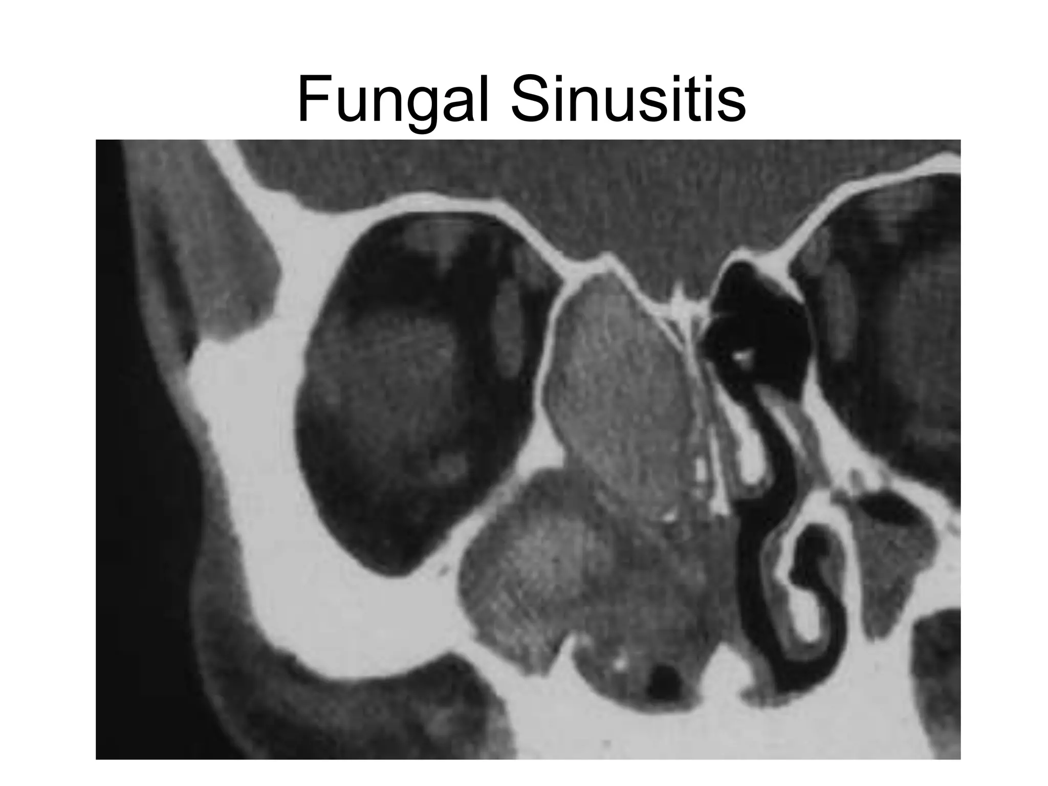 Sinus-Imaging.ppt