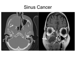 Sinus-Imaging.ppt