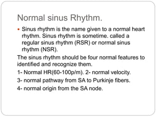 Sinus abnormality.pptx