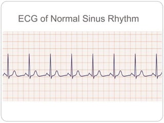Sinus abnormality.pptx