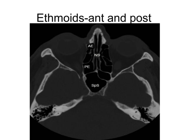 Sinus anatomy and variants | PPT