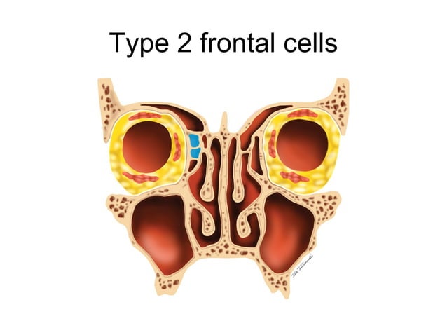 Sinus anatomy and variants | PPT