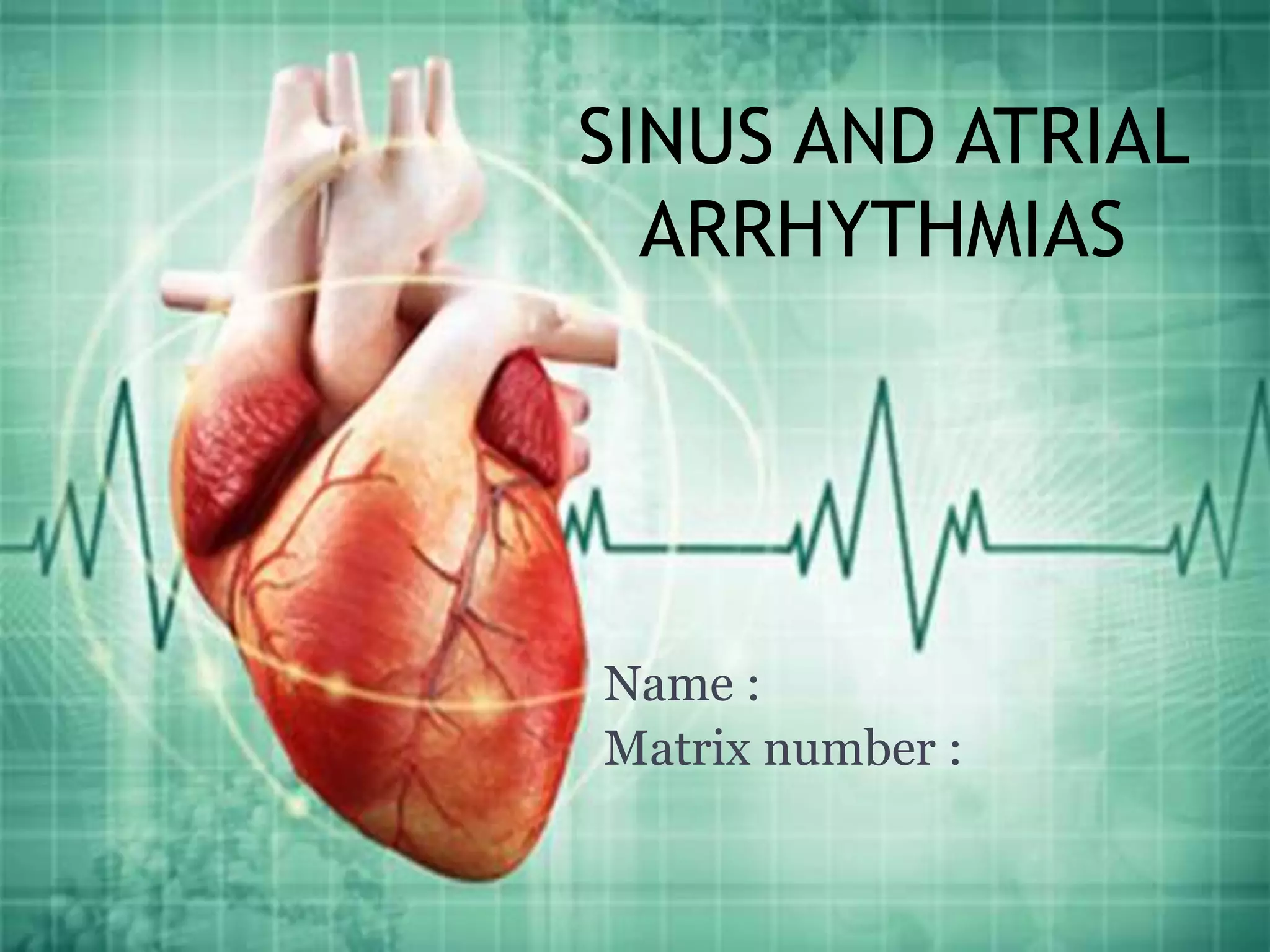 Sinus and atrial arrhythmias | PPTX