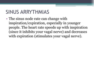 Sinus and atrial arrhythmias | PPTX