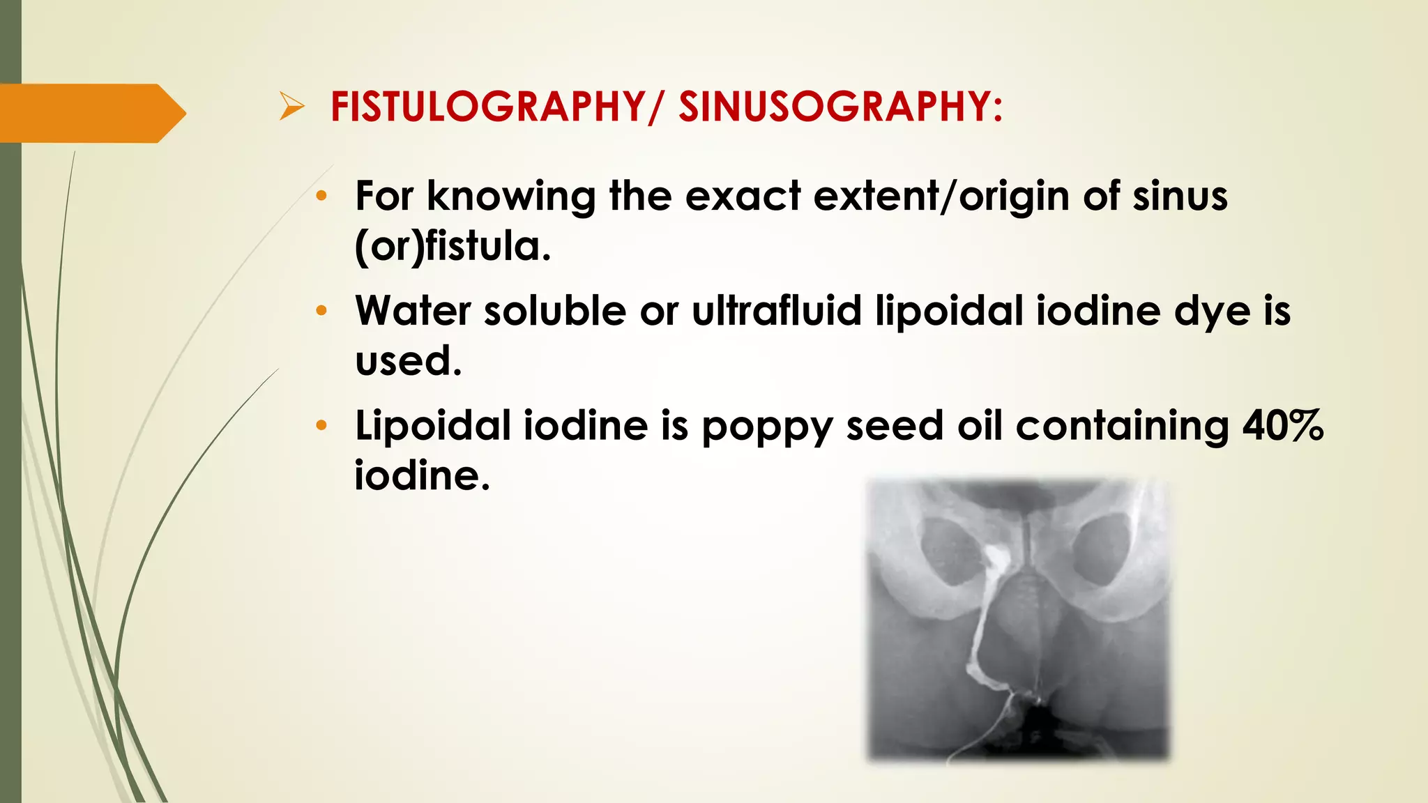 Sinus and fistula | PPTX