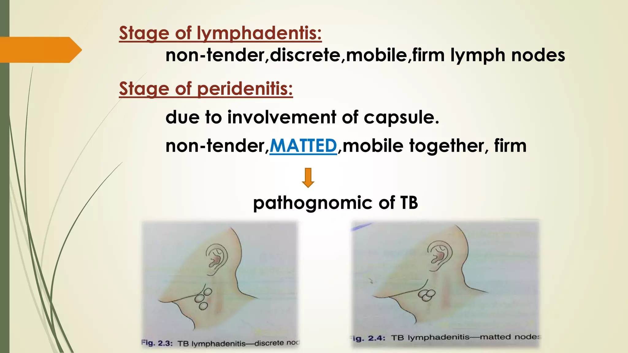 Sinus and fistula | PPTX