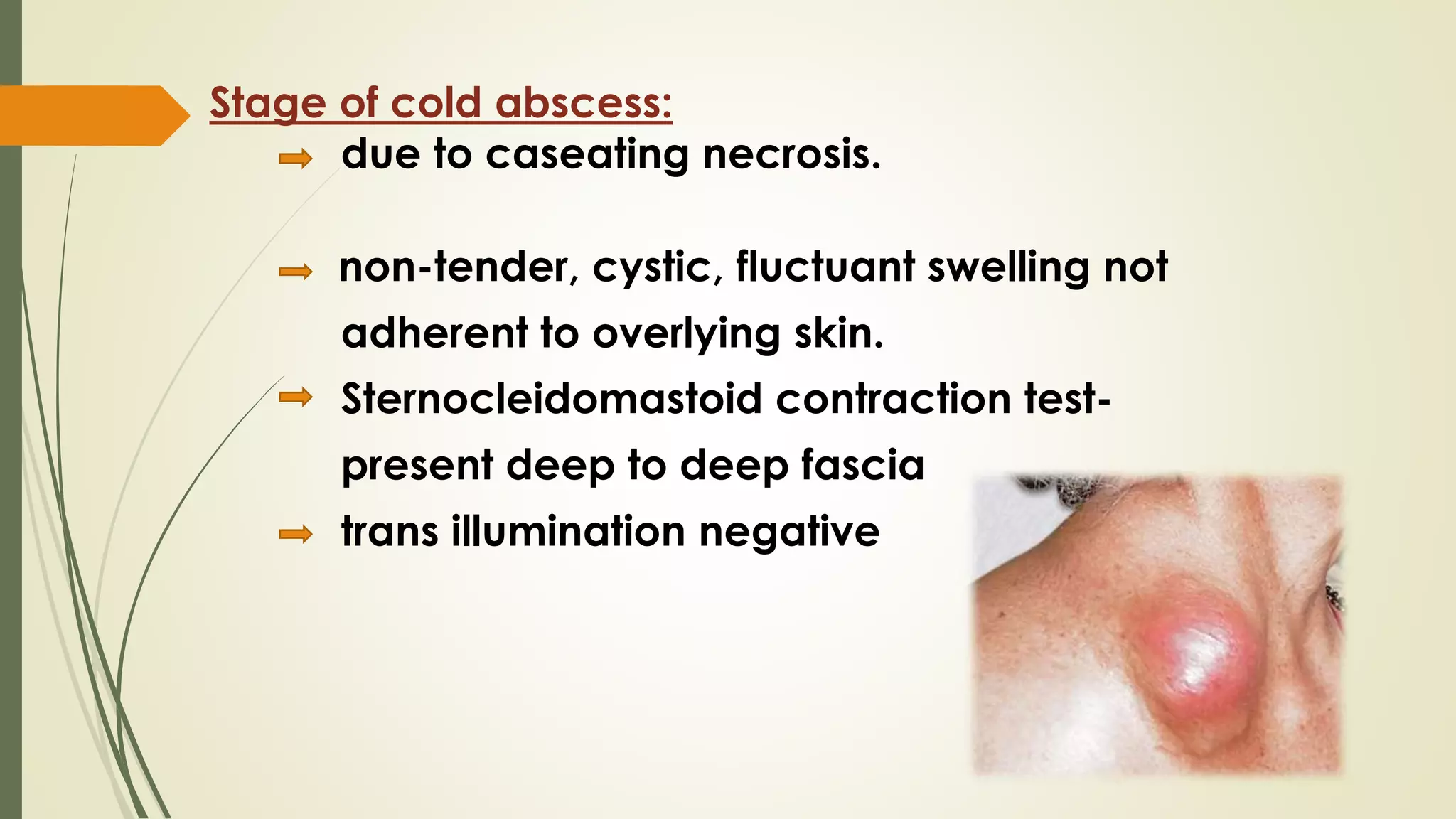 Sinus and fistula | PPTX