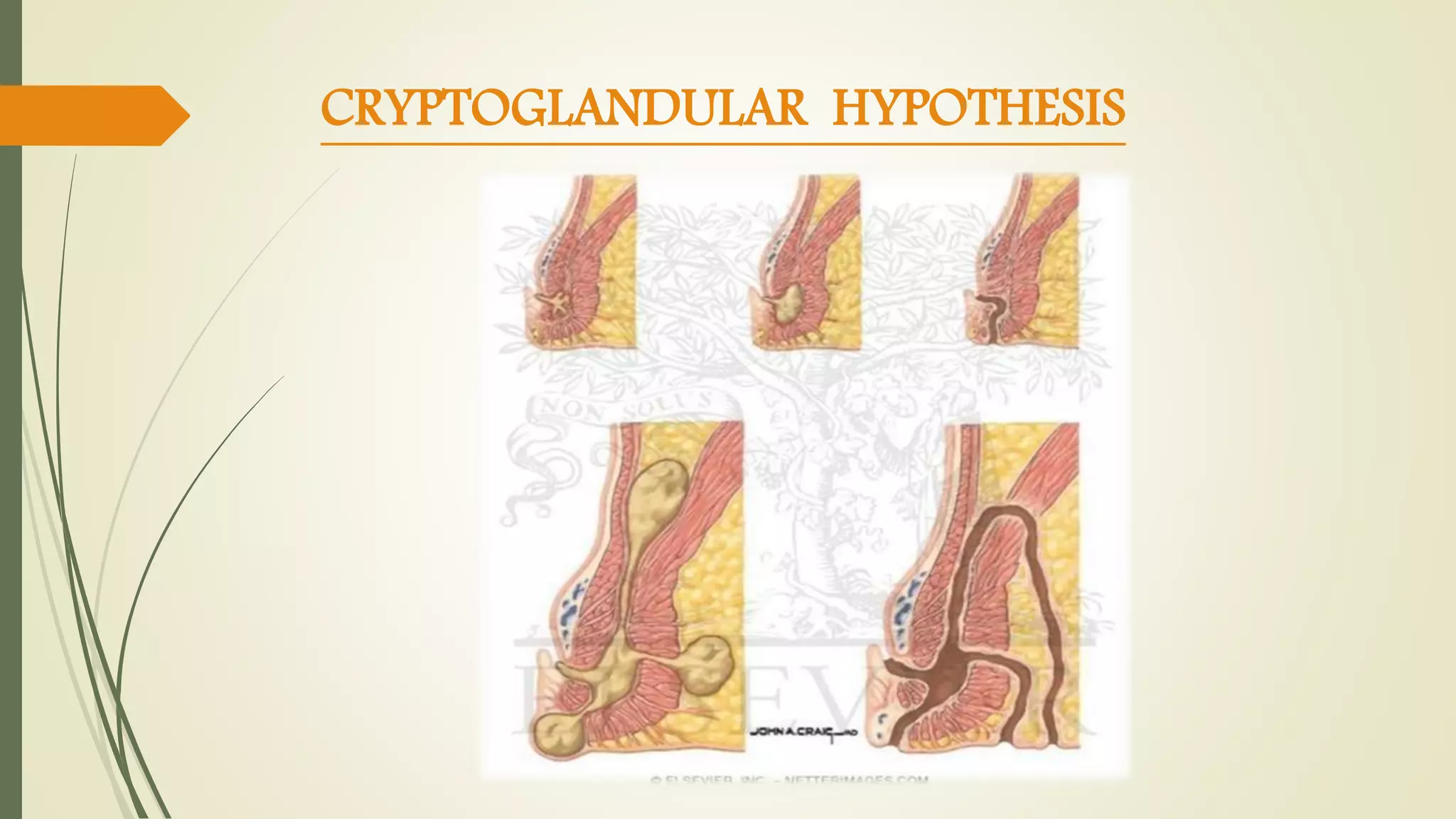 Sinus and fistula | PPTX