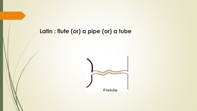Sinus and fistula | PPTX | Ear, Nose and Throat Conditions | Diseases ...