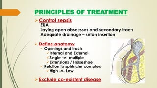 Sinus and fistula | PPTX