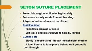 Sinus and fistula | PPT