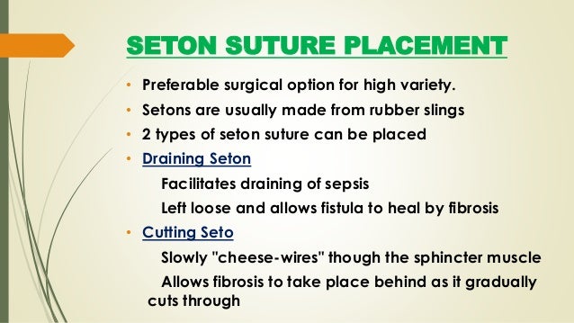 Seton For Anul Fistula | Division of Global Affairs