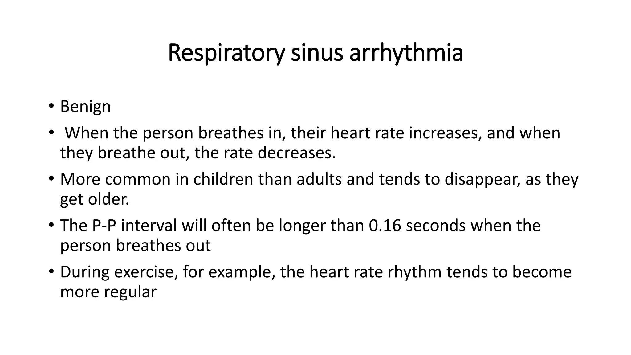 Sinus arrhythmia | PPTX