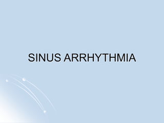 Sinus arrhythmia | PPT | Heart and Cardiovascular Diseases | Diseases ...