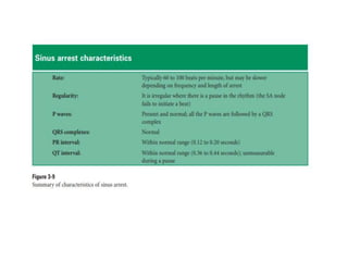 SINUS DYSRHYTHMIAS AND HOW TO DIAGNOSE IT? | PPTX