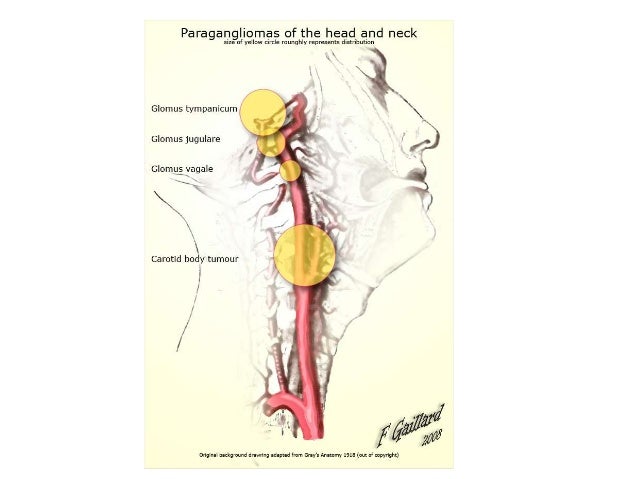 Sinuses & neck lesions