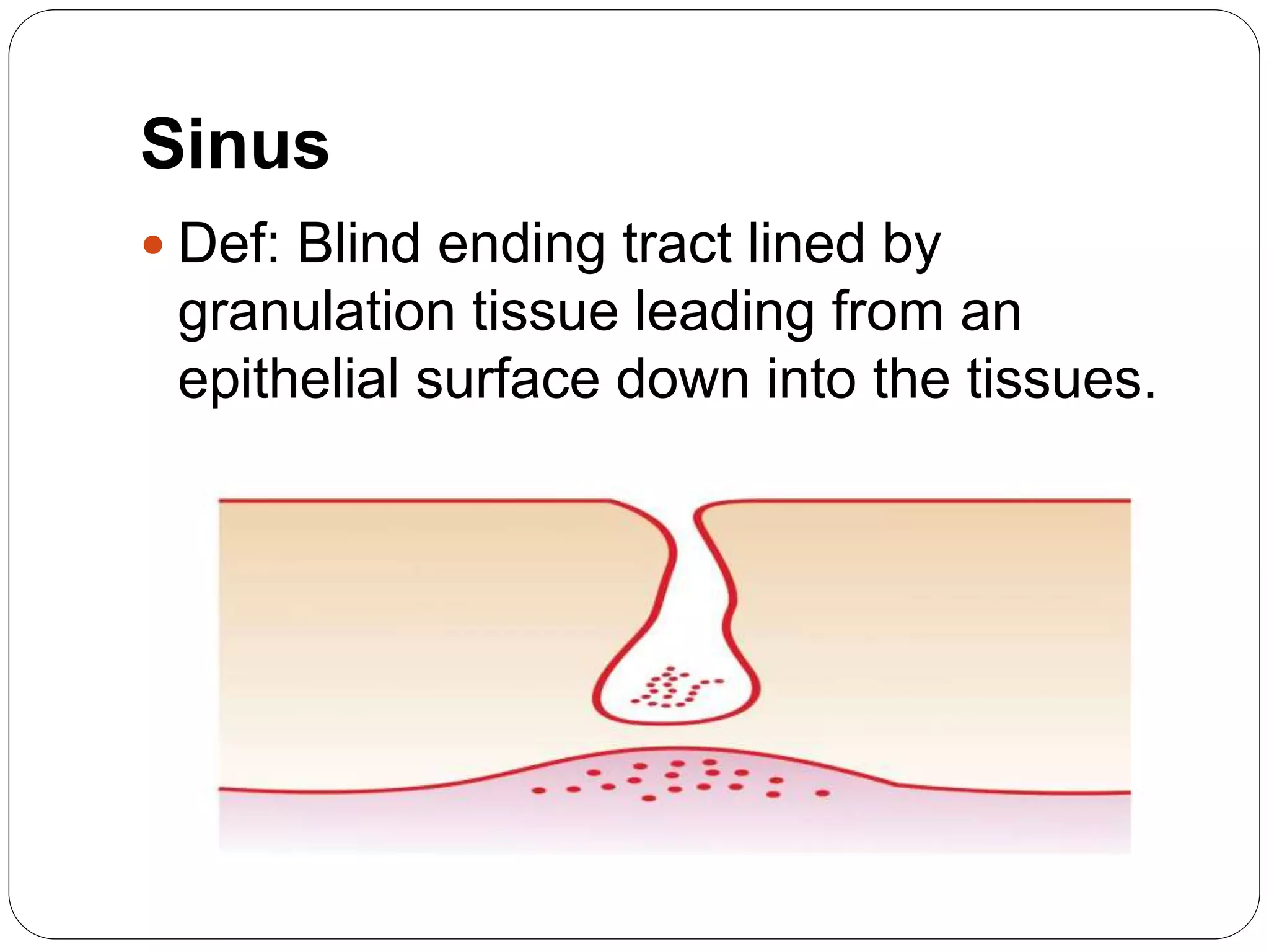 Sinus, fistula, cyst | PPTX