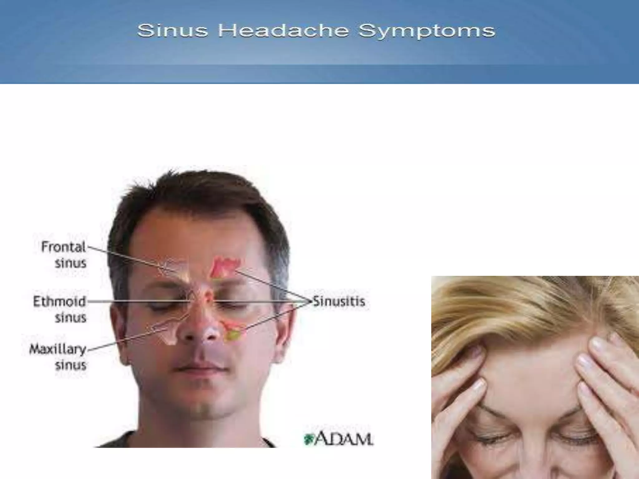 Sinus headache | PPTX
