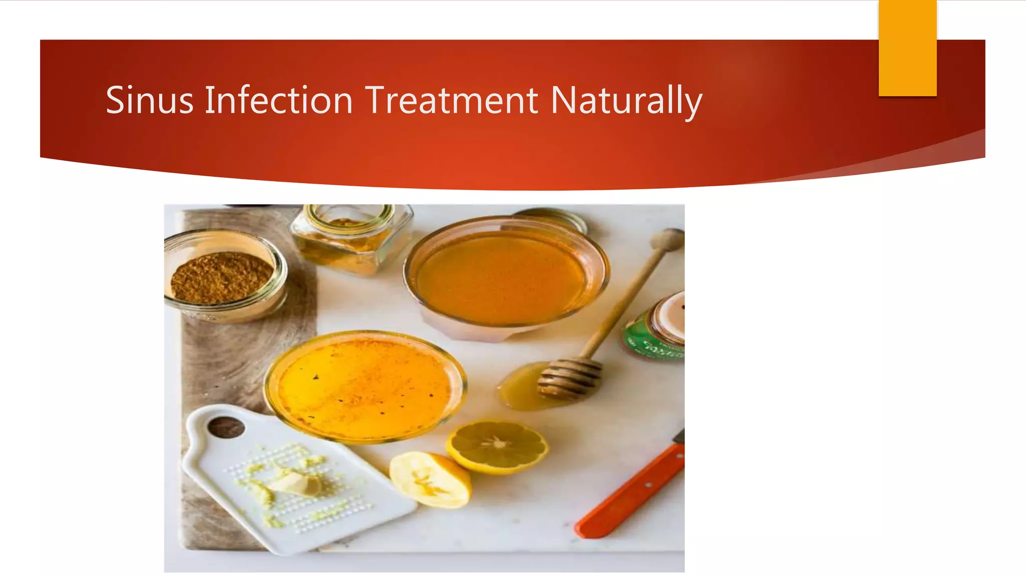 Sinus infection contagious | PPTX