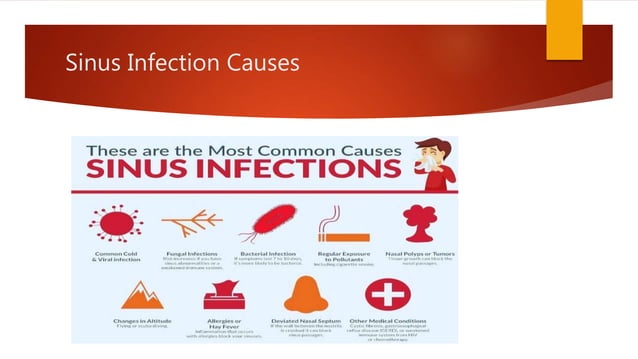 Sinus infection contagious | PPTX