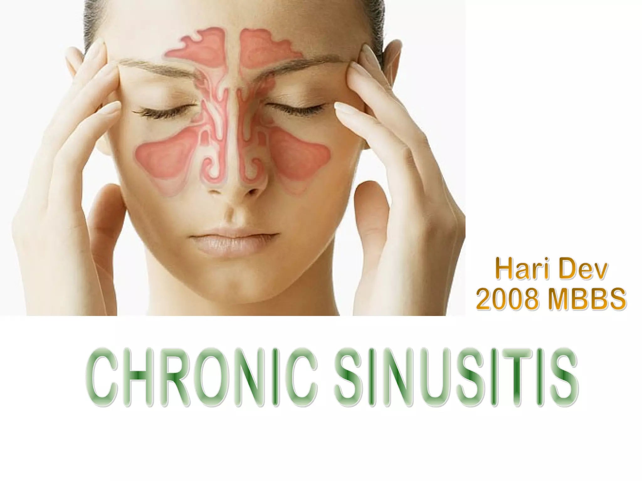Sinusitis | PPT