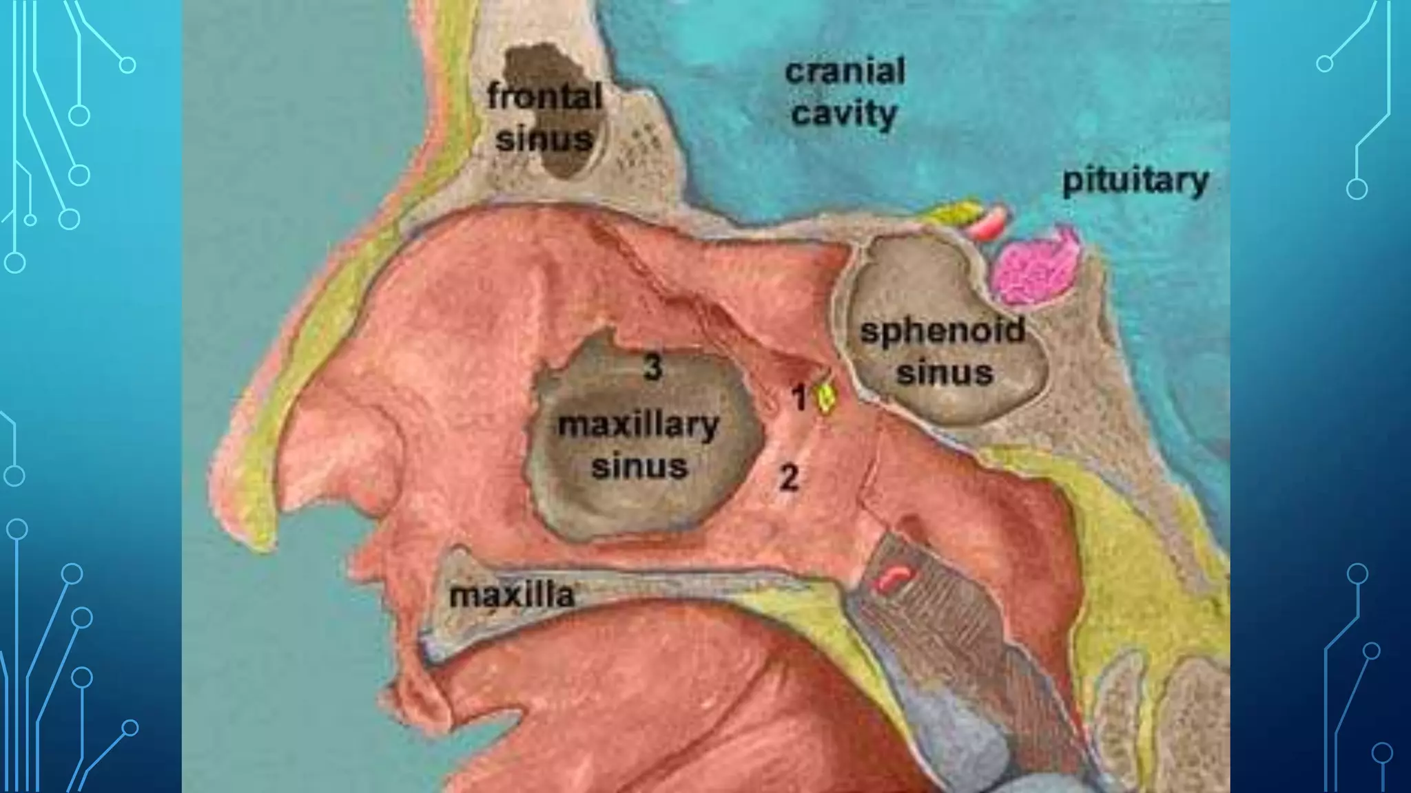 Sinusitis | PPTX