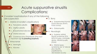 Sinusitis | PPTX