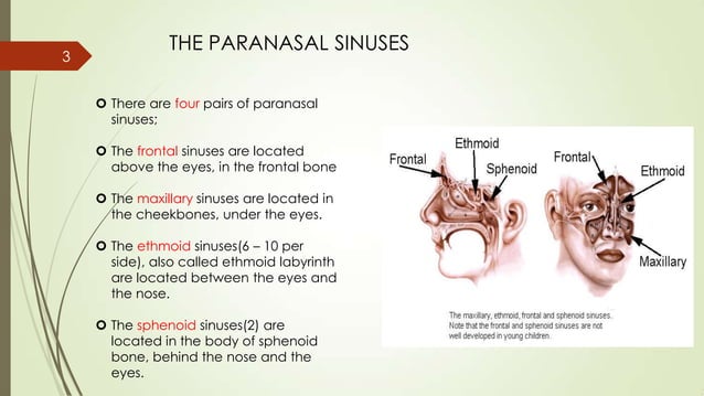 Sinusitis | PPTX | Ear, Nose and Throat Conditions | Diseases and ...
