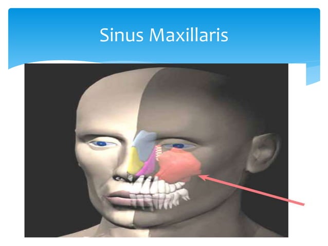 Sinusitis dan Penanganan Fisioterapi | PPTX