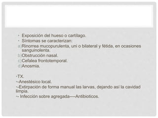 Sinusitis | PPTX