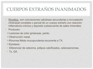 Sinusitis | PPTX