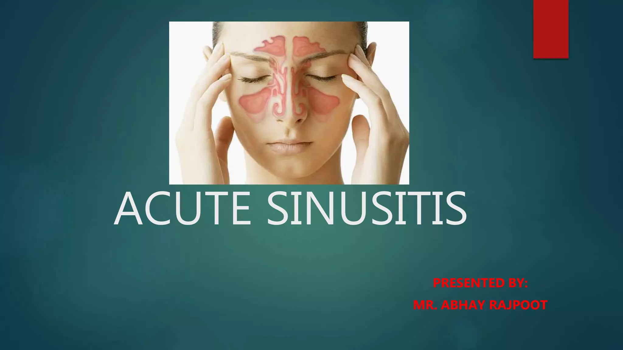 Sinusitis | PPTX