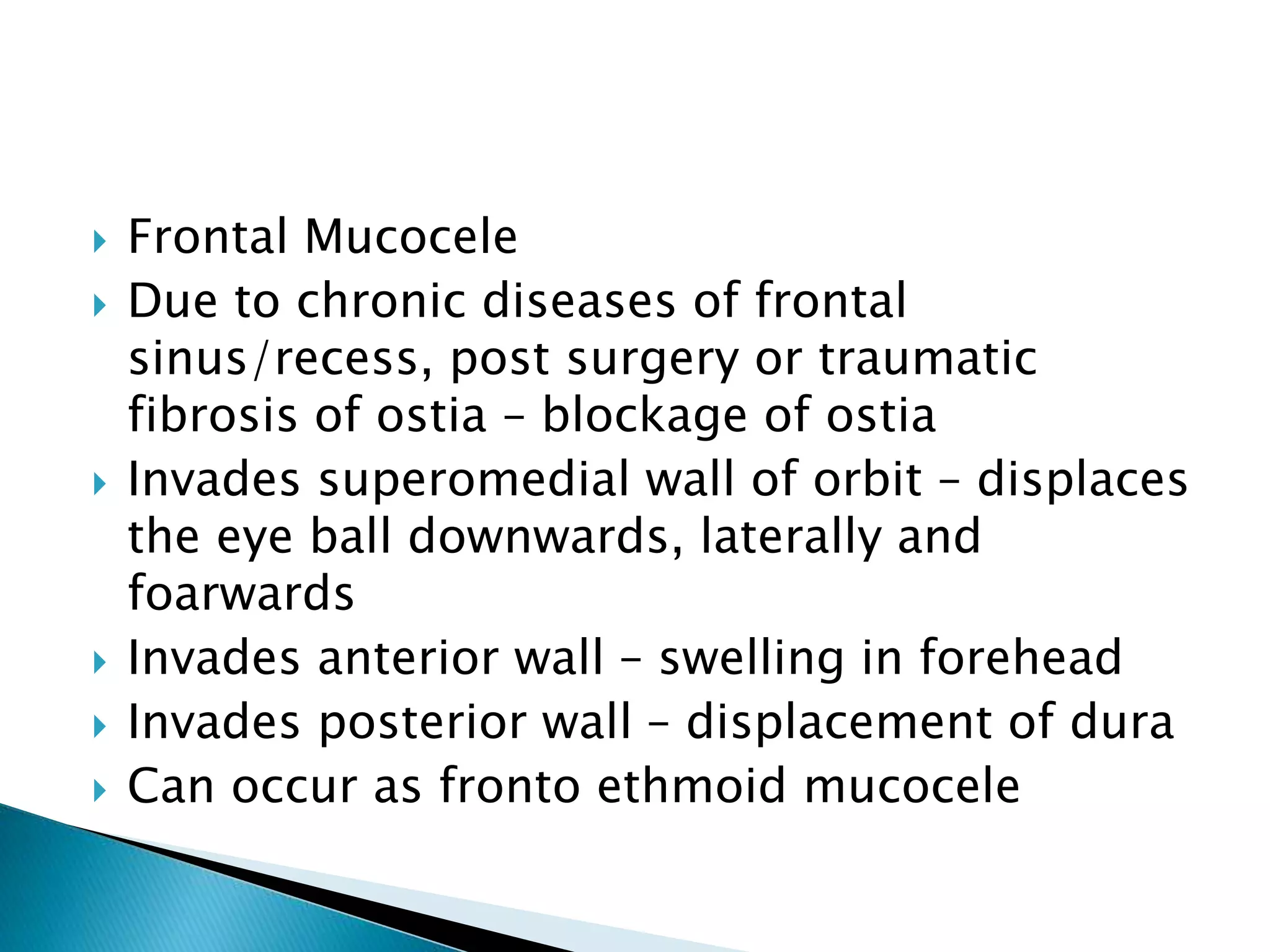 Sinusitis | PPTX