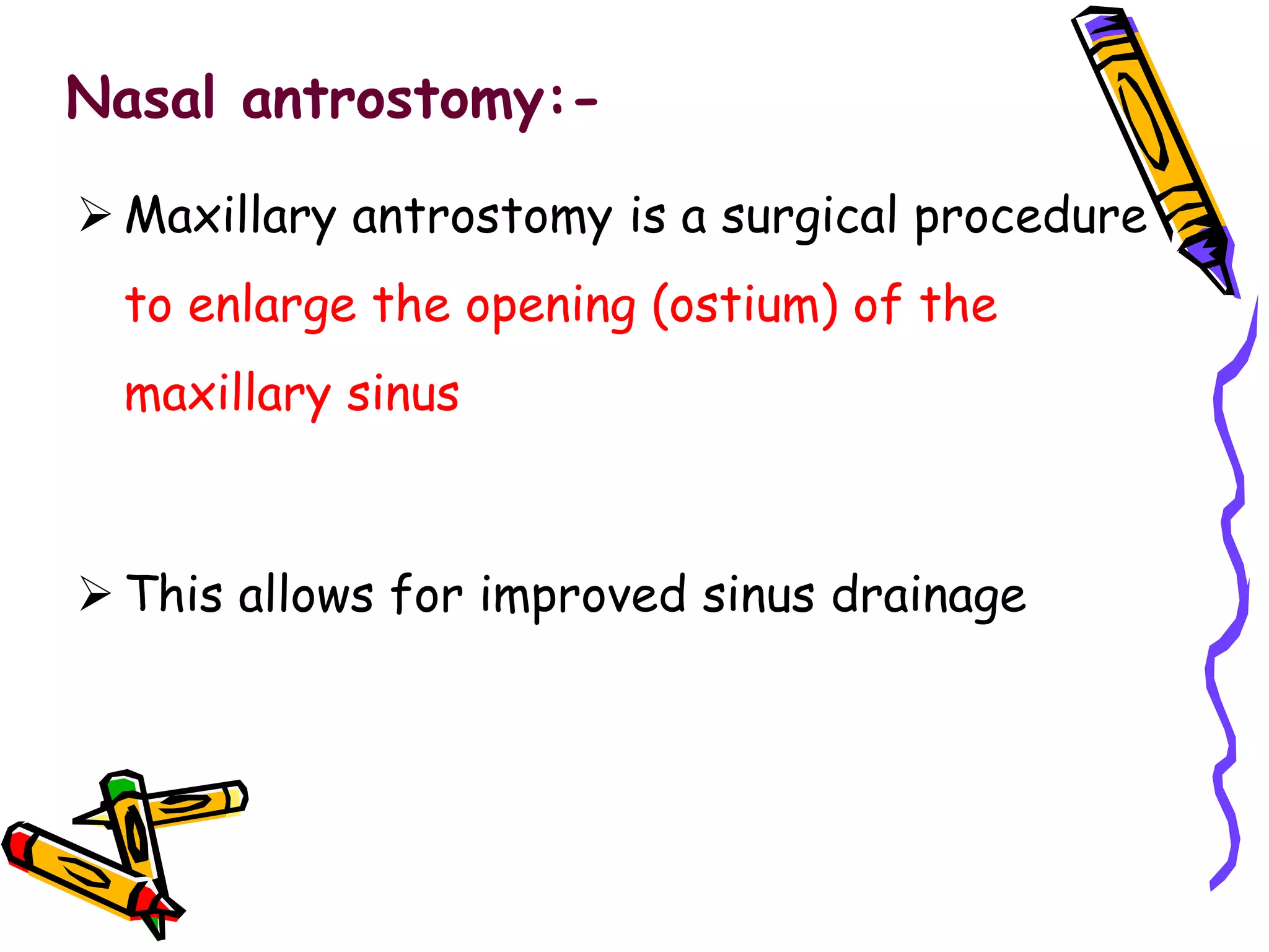 Sinusitis | PDF