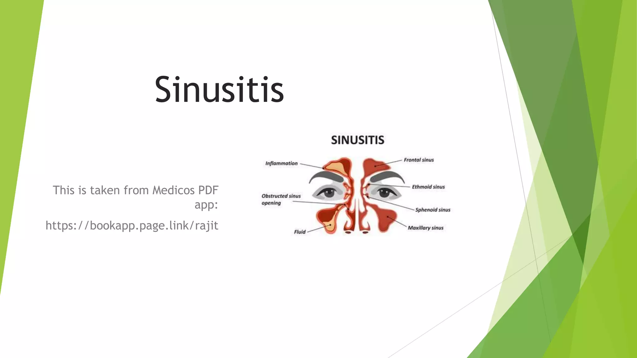 Sinusitis | PPT